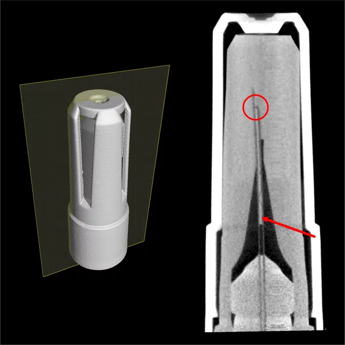 Clogging in staked-in needle pre-filled syringes (SIN-PFS): Influence ...