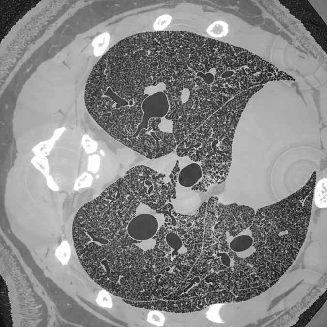 Micrometer-resolution X-ray tomographic full-volume reconstruction of ...