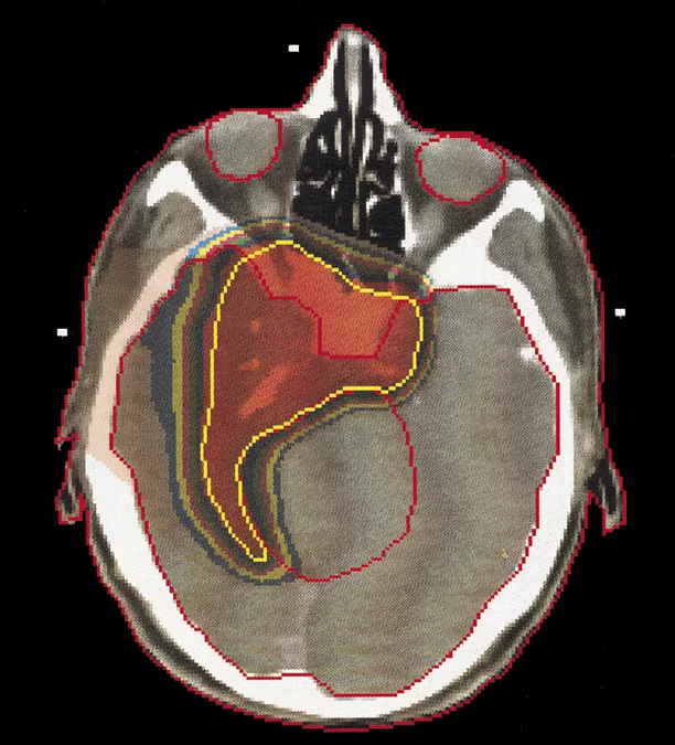 The spot-scanning technique | CPT | Paul Scherrer Institut (PSI)